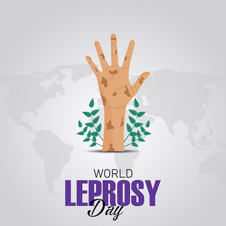 World Leprosy Day 2025: Date, Theme, History, And Significance | Herzindagi