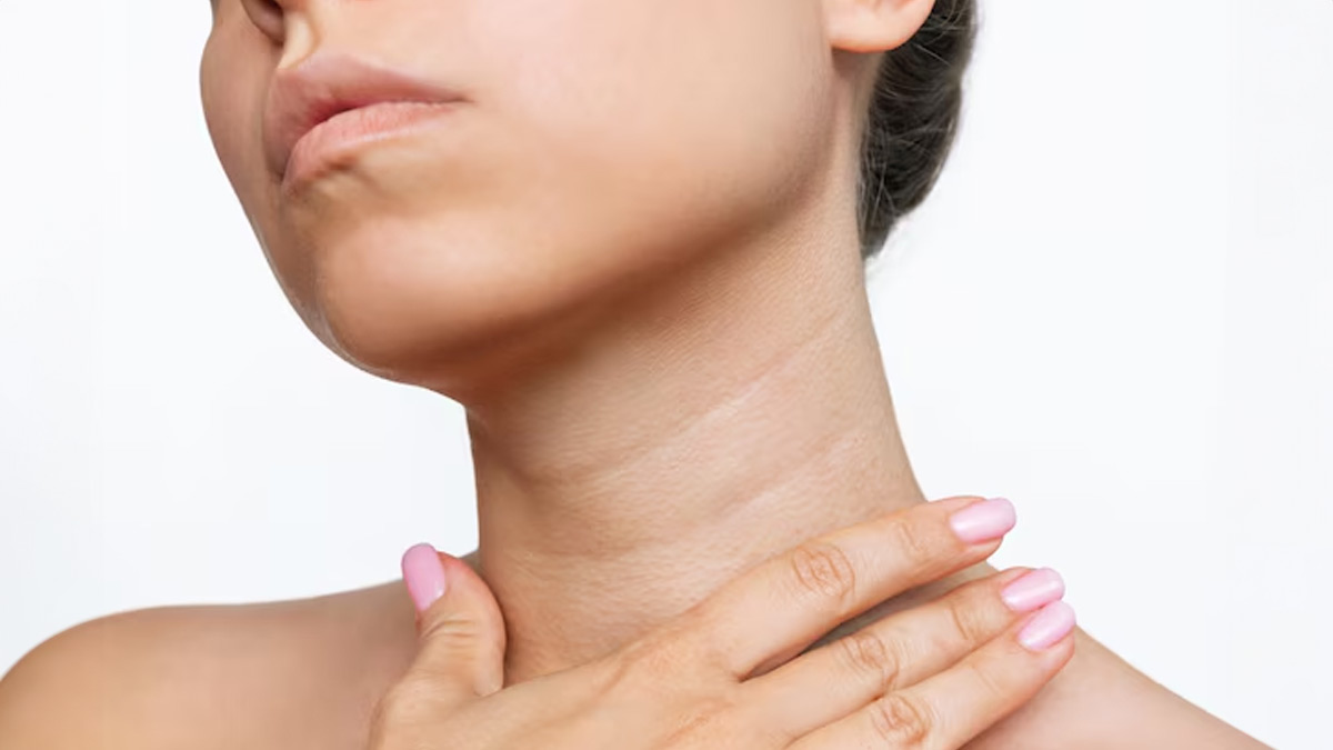 Neck Lines And Ageing: 5 Reasons And Preventative Tips By Expert ...