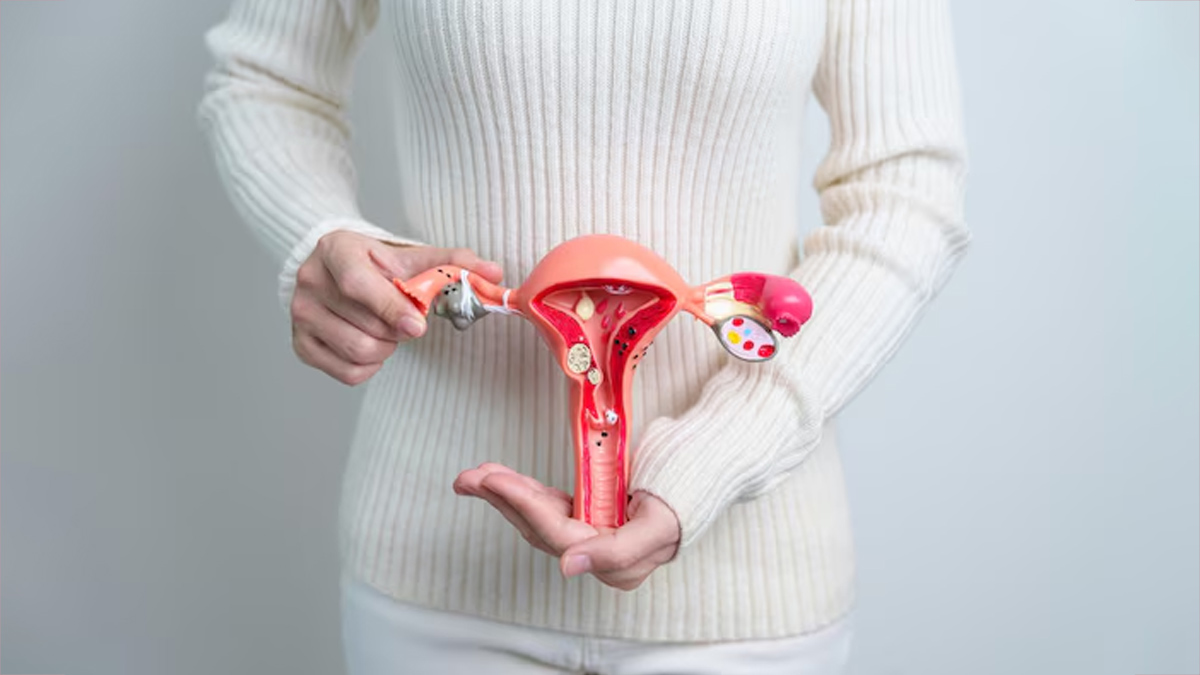 PCOS Explained: Common Symptoms, Effective Treatments, and More ...