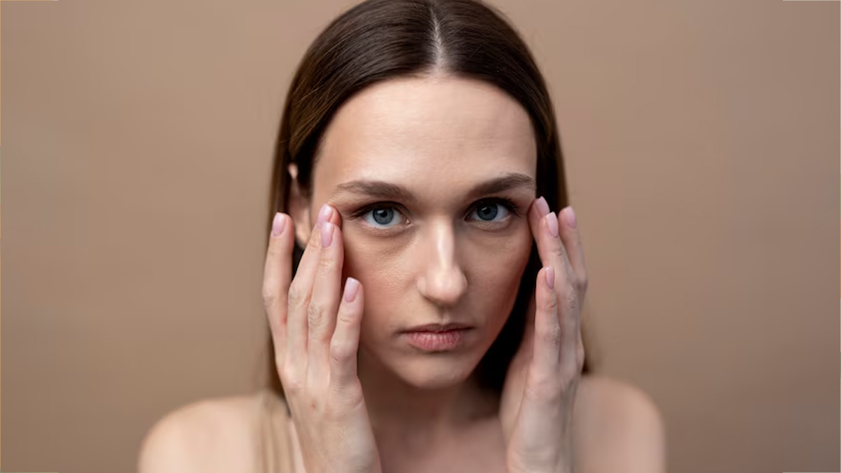 Top 7 Expert Suggested Tricks And Tips To Get Rid Of Dark Circles