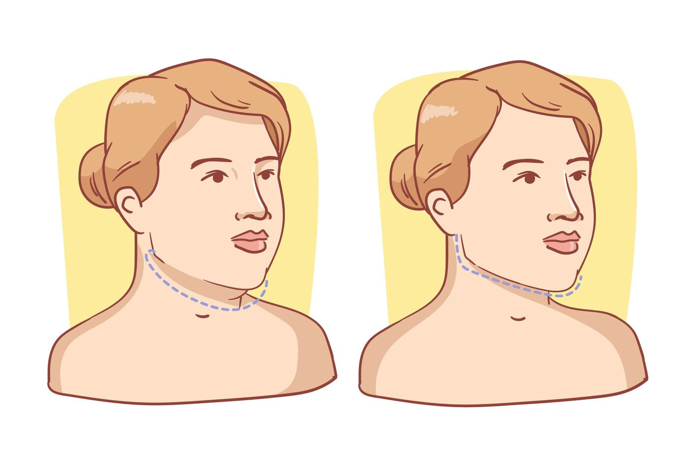 How to Reduce Double Chin: फेस योगा से कम करें डबल चिन, जानिए कैसे 7 ...