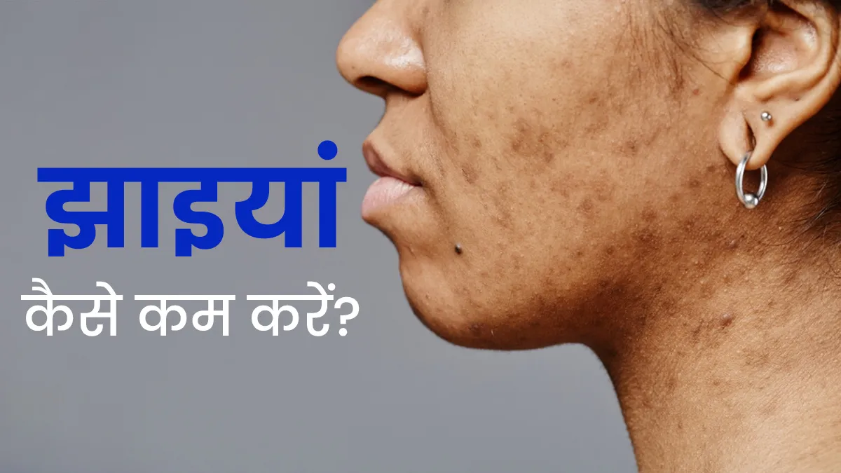 चेहरे की पुरानी झाइयां कम करने के 5 आसान स्टेप्स, हफ्ते भर में मिल सकती ...