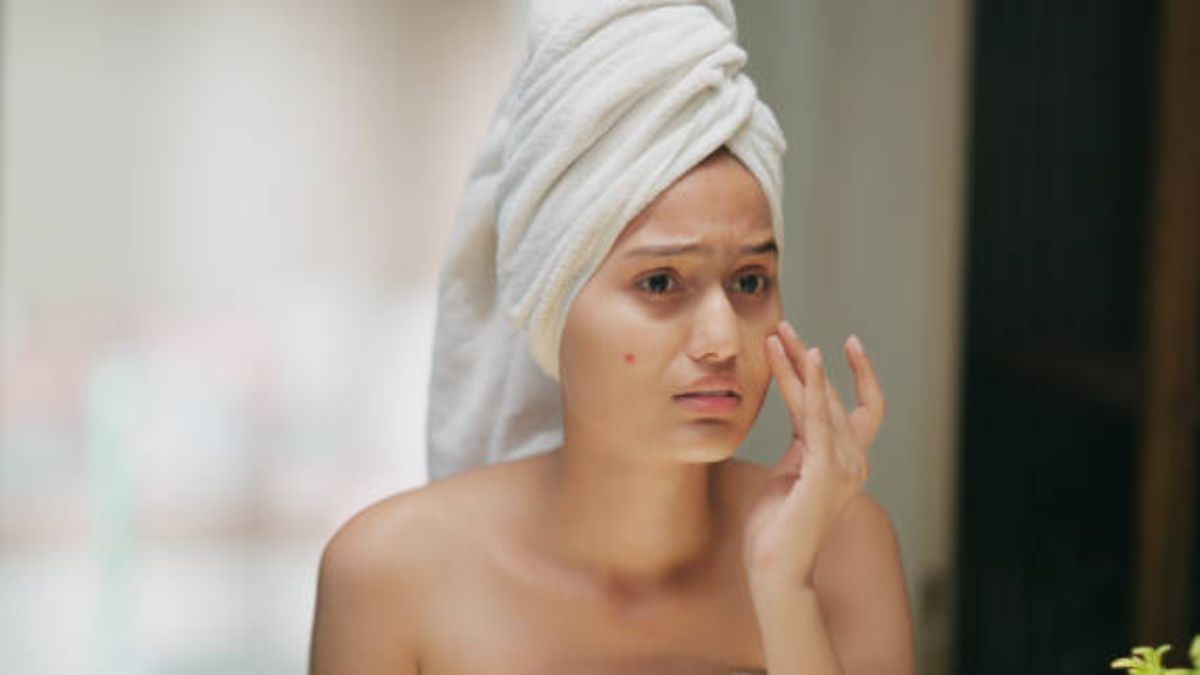 Blackheads Removal Tips: चेहरे के जिद्दी ब्लैकहेड्स को दूर कर सकता है ...