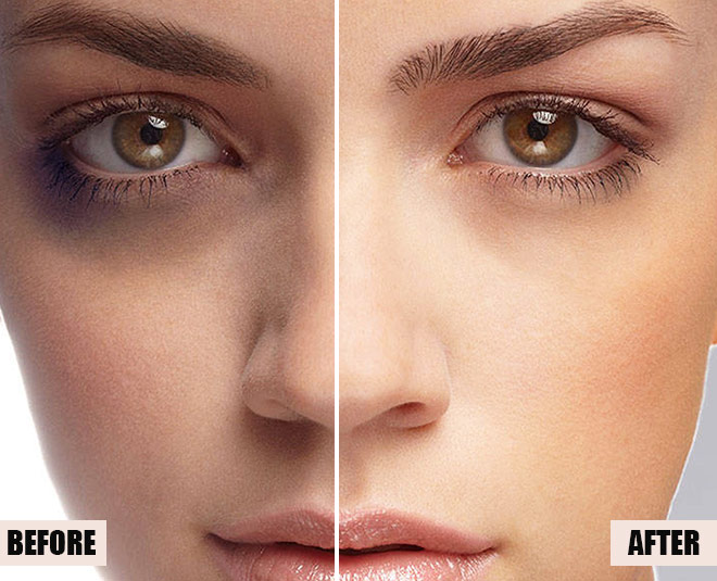 Dark Circles Eat These 5 Foods Flaunt Your Eyes Naturally HerZindagi Dark Circles Eat These 5 Foods Flaunt Your Eyes Naturally HerZindagi