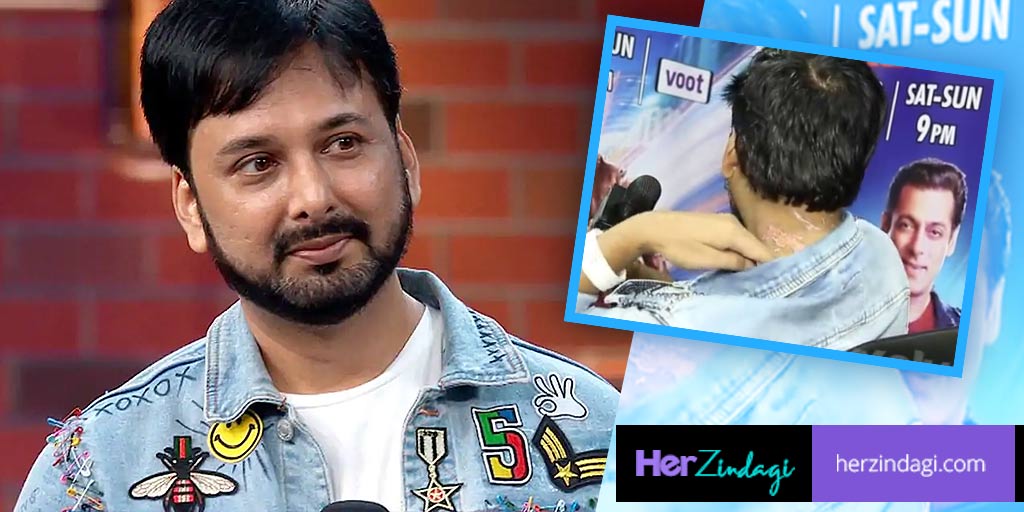 See Video: Bigg Boss 13 Contestant Shows His Burn Marks After Getting ...