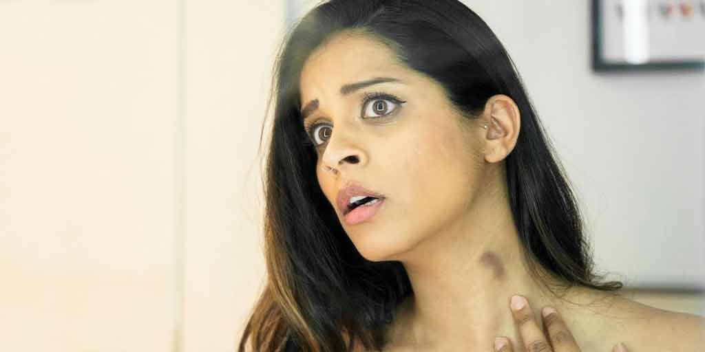 Try These Simple Home Remedies To Get Rid Of A Hickey Asap Try These Simple Home Remedies To