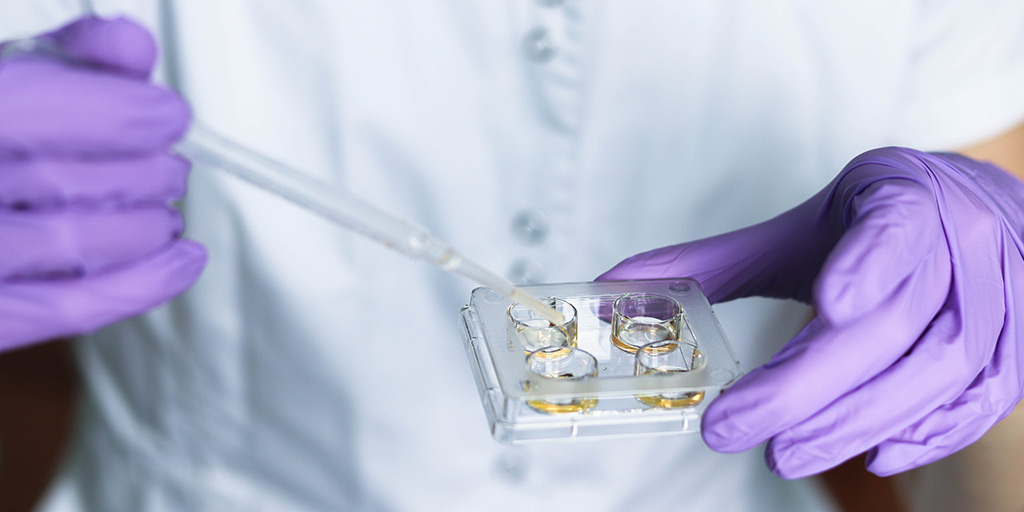 Know Everything About Embryo Cryopreservation And Why It Is An ...