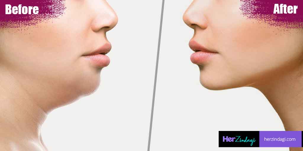Face Slimming: Expert Best Facial Yoga to Get Rid of Double Chin | best ...