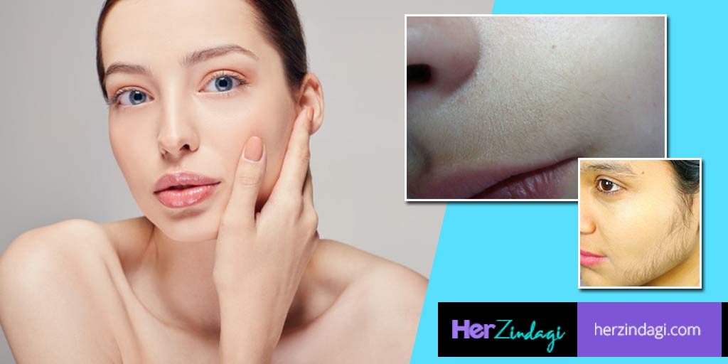Homemade Ubtans To Naturally Remove Peach Fuzz | HerZindagi
