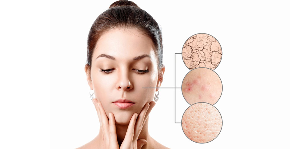 Effective Home Remedy For Dryness, Wrinkles And Pigmentation In Winter ...