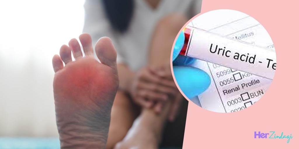 Easiest Way To Treat Uric Acid By Expert | easiest way to treat uric ...