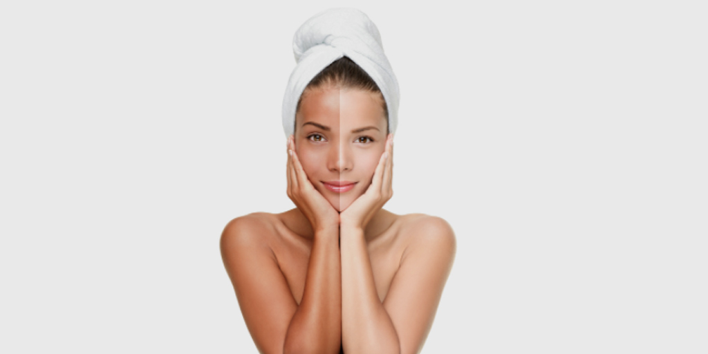 Homemade Face Pack For Sunburn | homemade face pack for sunburn ...