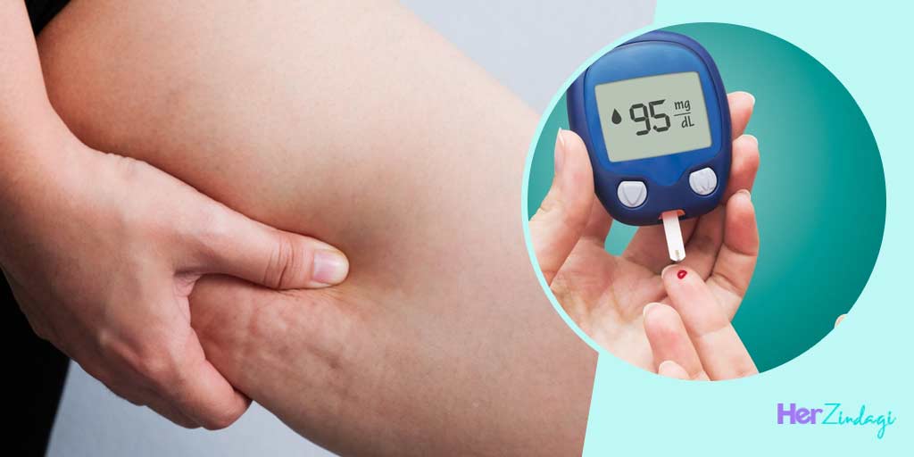 Skin Changes That Are Early Signs Of Diabetes | skin changes that are ...