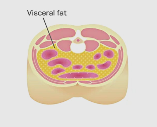 Tips to Reduce Visceral Fat | tips to reduce visceral fat | Herzindagi