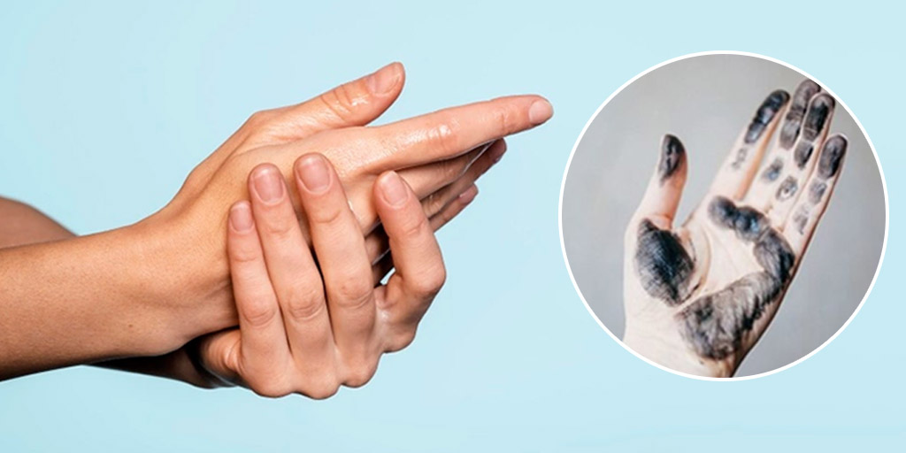 How To Get Rid Of Dye Stains On Hands-इन टिप्स की मदद से हाथों पर लगे ...