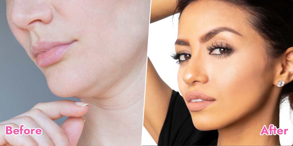 Expert Tips: Yoga for Sharp Jawline | how to have a better jawline ...