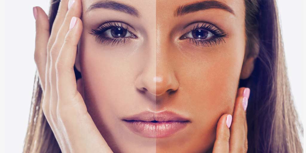 How to De Tan Naturally at Home -टैनिंग से चेहरे हो गया है डार्क, इन ...