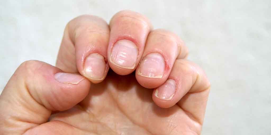 What Do Your Nails Say About Your Personality-नाखूनों का शेप बता सकता ...