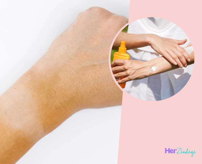 हाथों की टैनिंग को कम करने के लिए अपनाएं ये टिप्‍स | how to get rid of ...