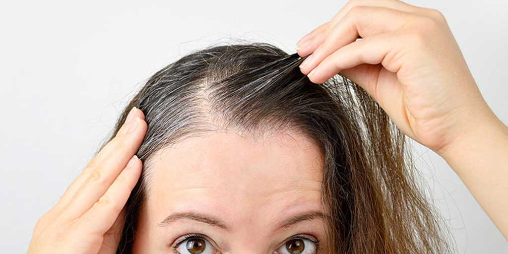 How to Control Hair Loss in Women by Exercise and Lifestyle Tips-झड़ते ...