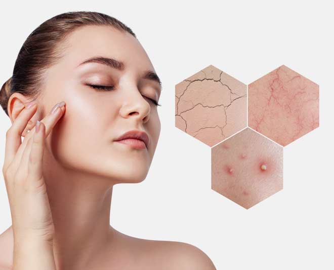 सर्दियों में फट जाते हैं गाल और चेहरा होता है लाल तो अपनाएं ये टिप्स ...