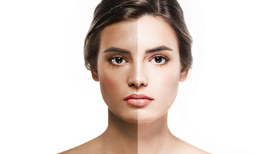 How To Remove Neck Tanning With Tomato-टमाटर की मदद से इस तरह करें ...