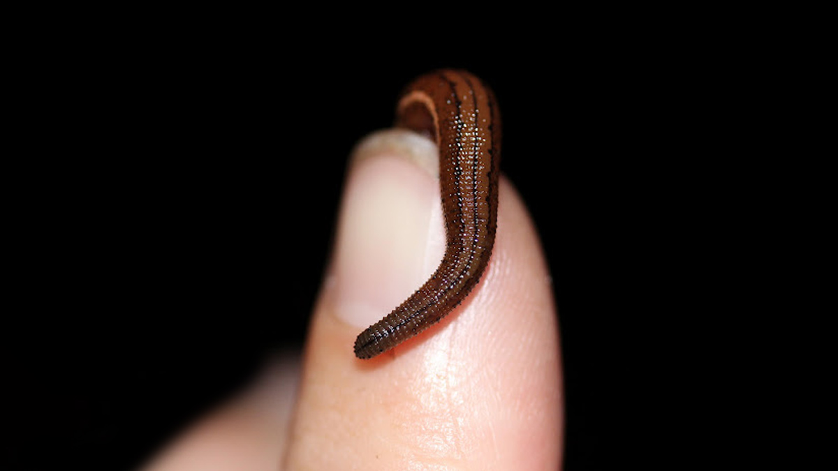 What Is Female Virginity| लीच थेरेपी| Virginity lost Ka Matlab | female ...