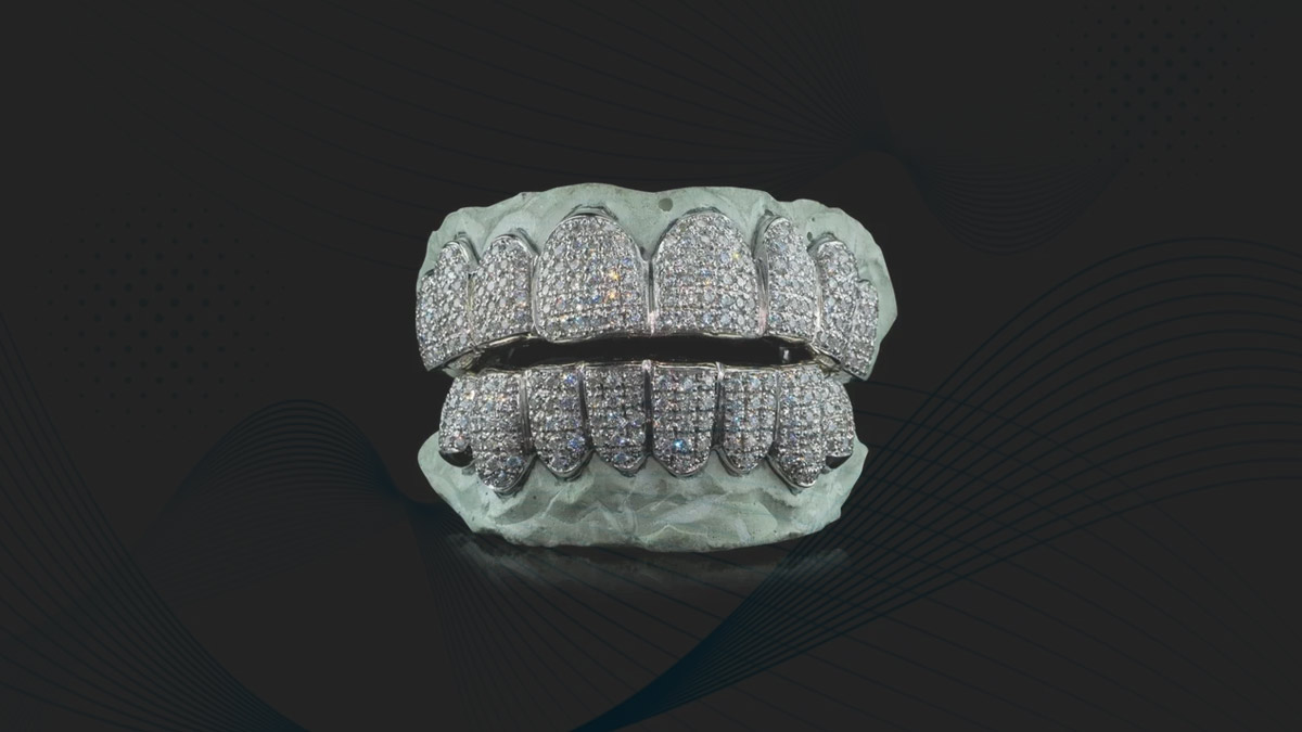 Surat Jewellers Selling Diamond Dentures For A Whopping Price | Herzindagi