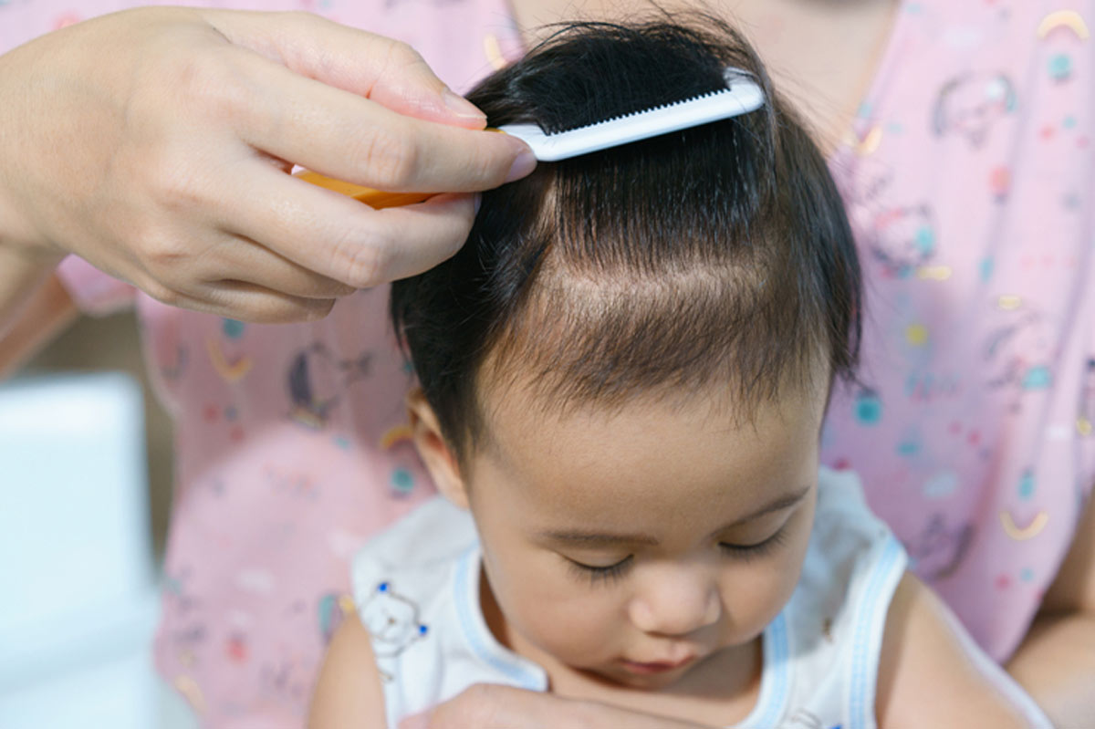 Baby Hair Care Guide: Follow These Tips During The Hot Season | Herzindagi
