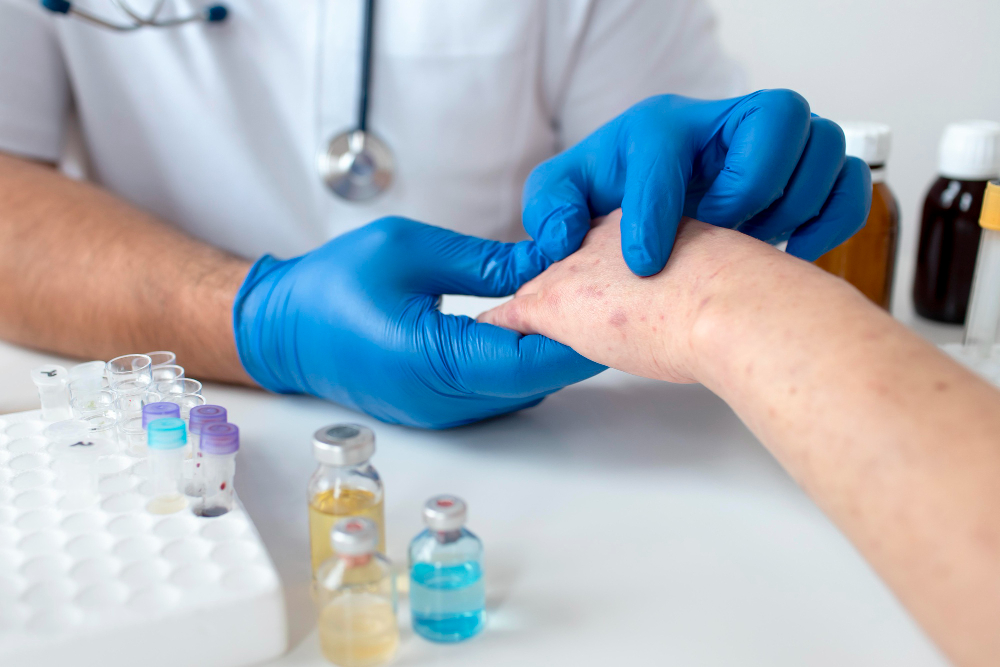 Mpox Disease Explained Symptoms Treatment And Prevention Herzindagi