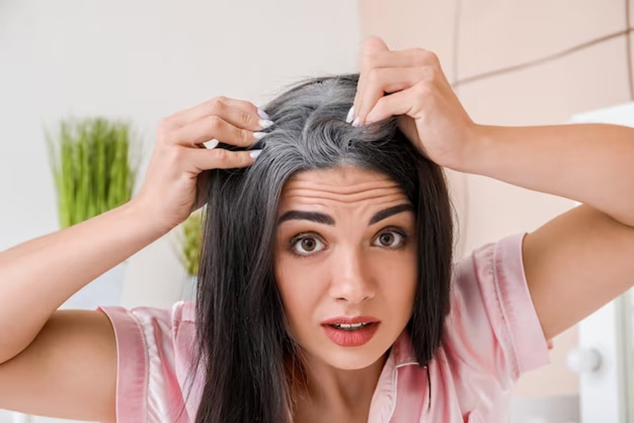 White Hair Problem: 20 की उम्र में क्यों सफेद होने लगते हैं बाल ...